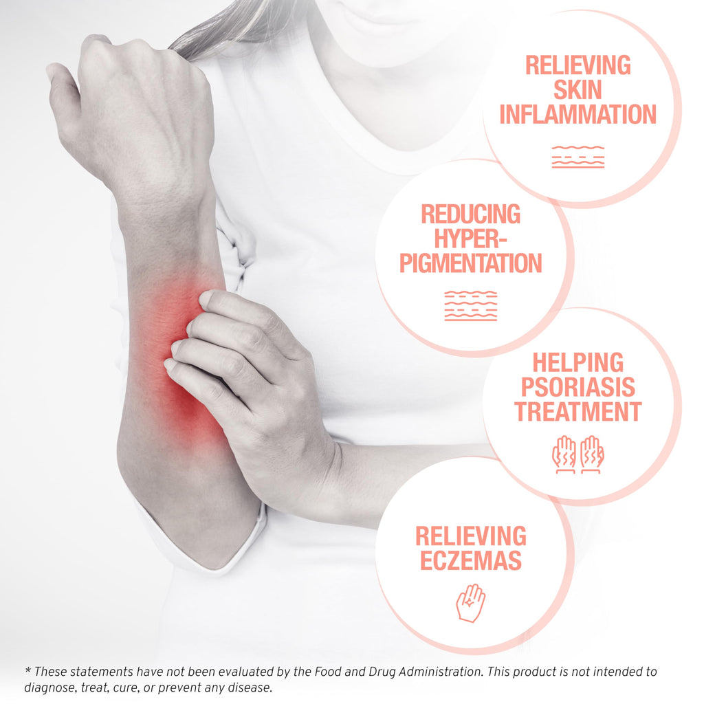 natural remedy for eczema relief