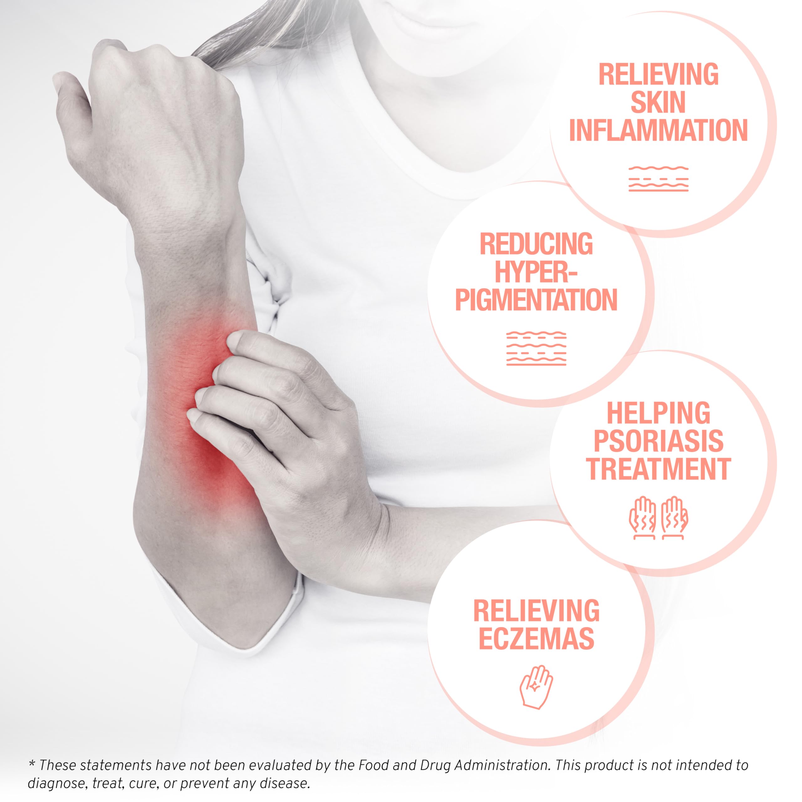 natural remedy for eczema relief