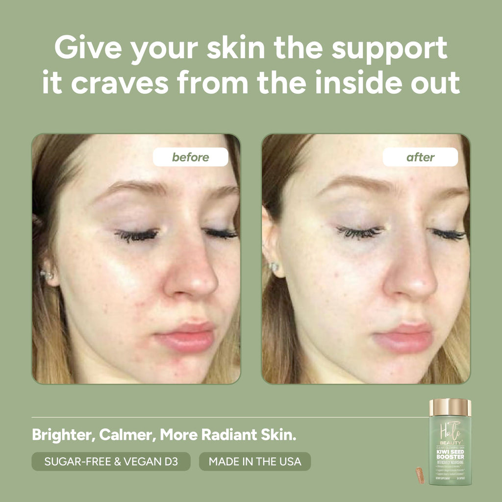 Natural skin supplement with kiwi seed