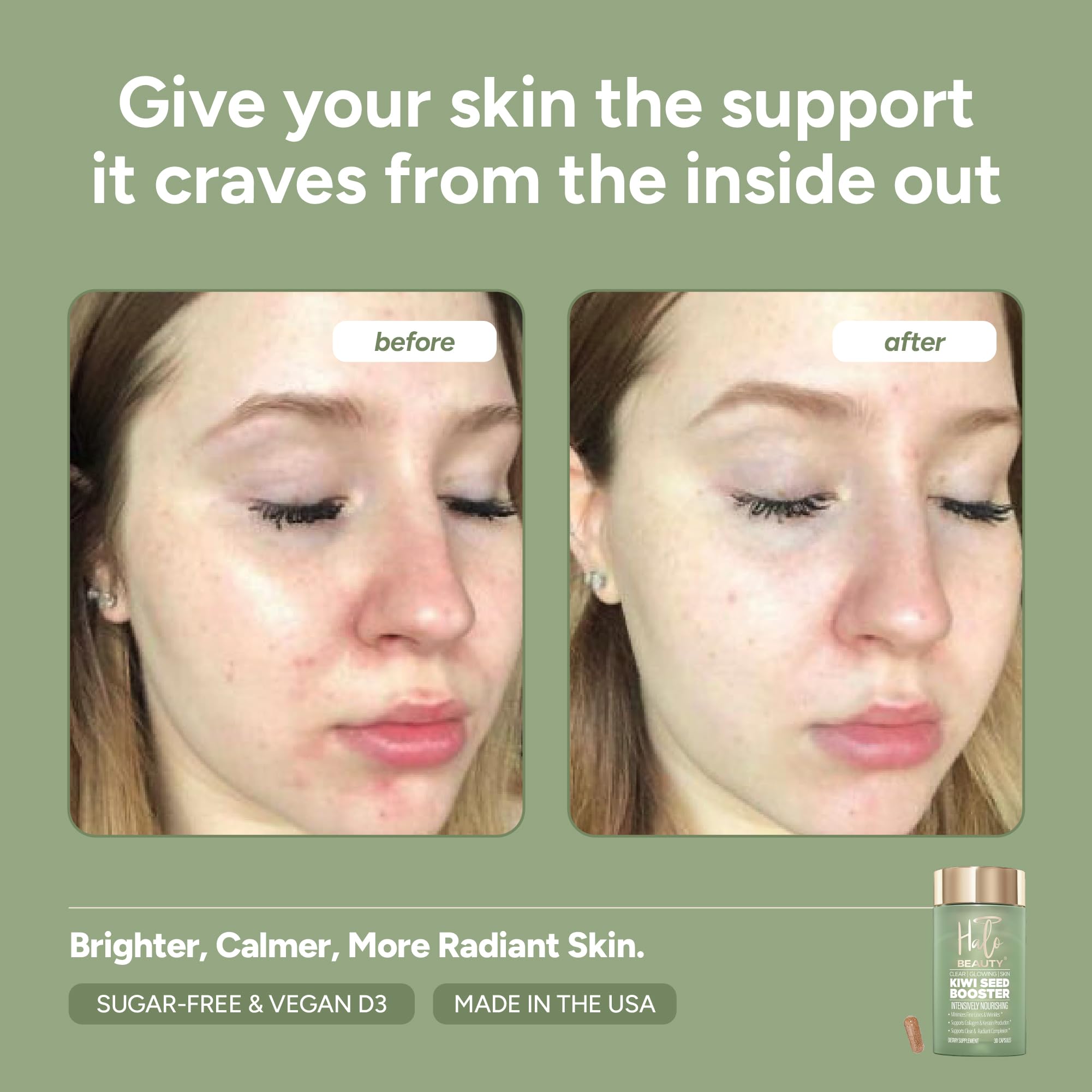 Natural skin supplement with kiwi seed