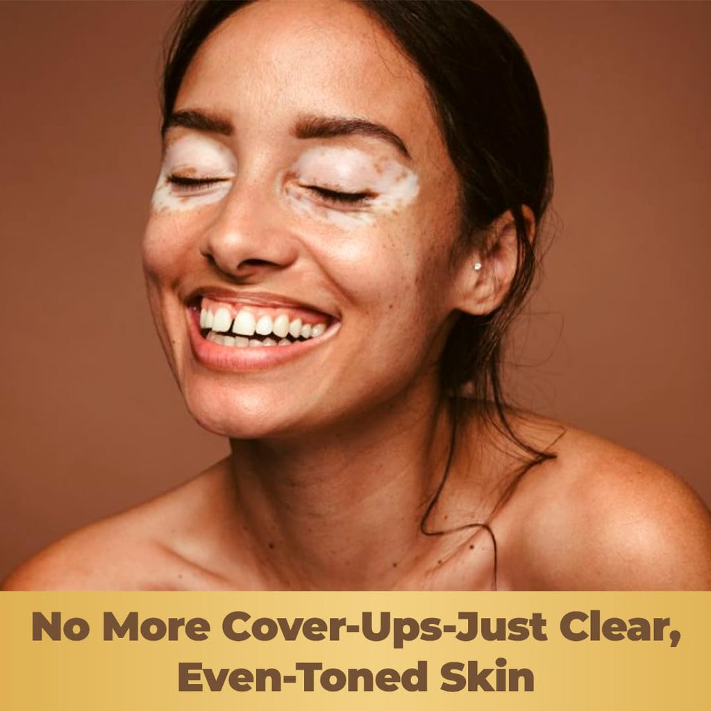 natural supplements for vitiligo care