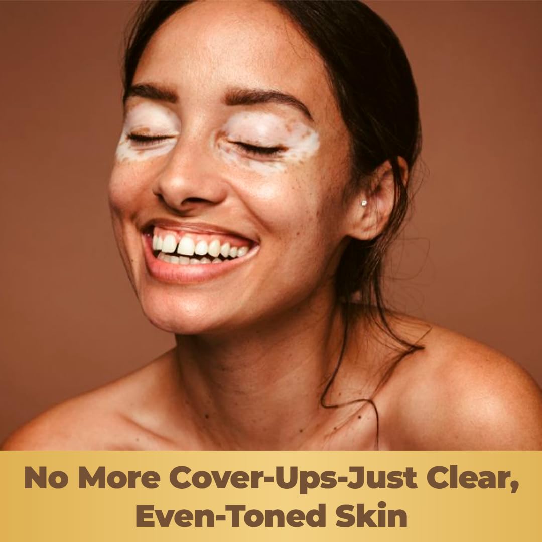 natural supplements for vitiligo care