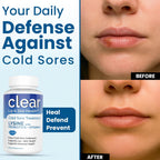 Natural support for cold sores
