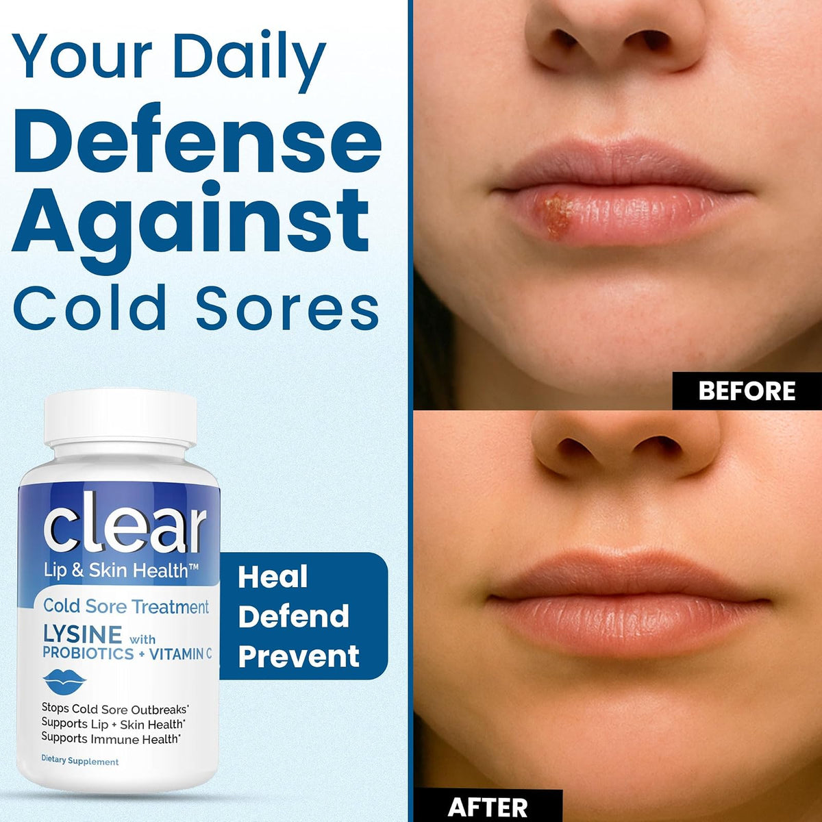 Natural support for cold sores