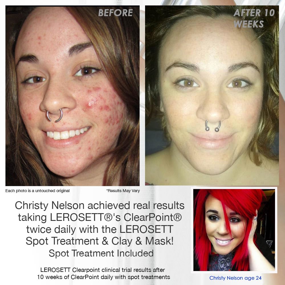 natural vitamins for clearer skin