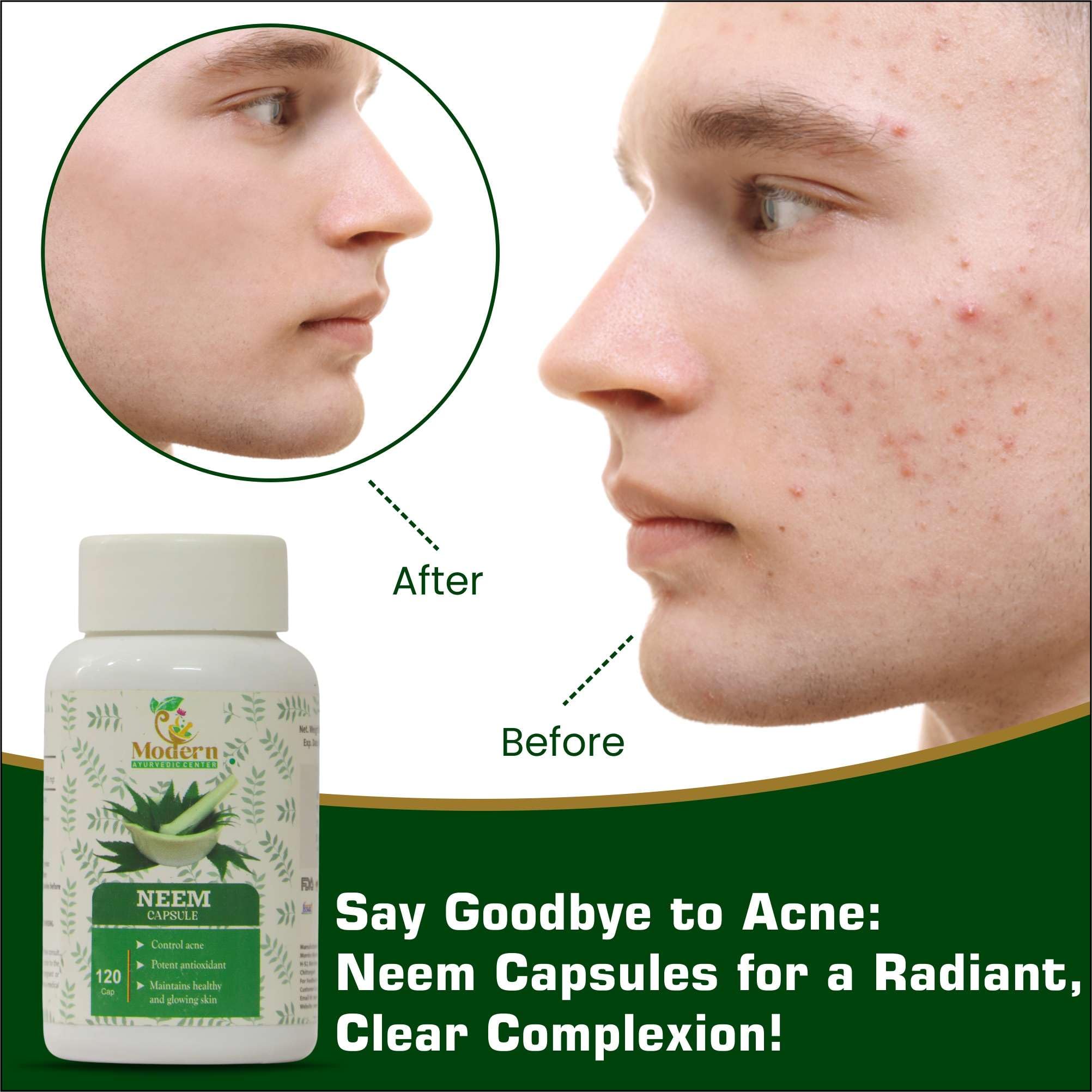 neem supplement for clear complexion