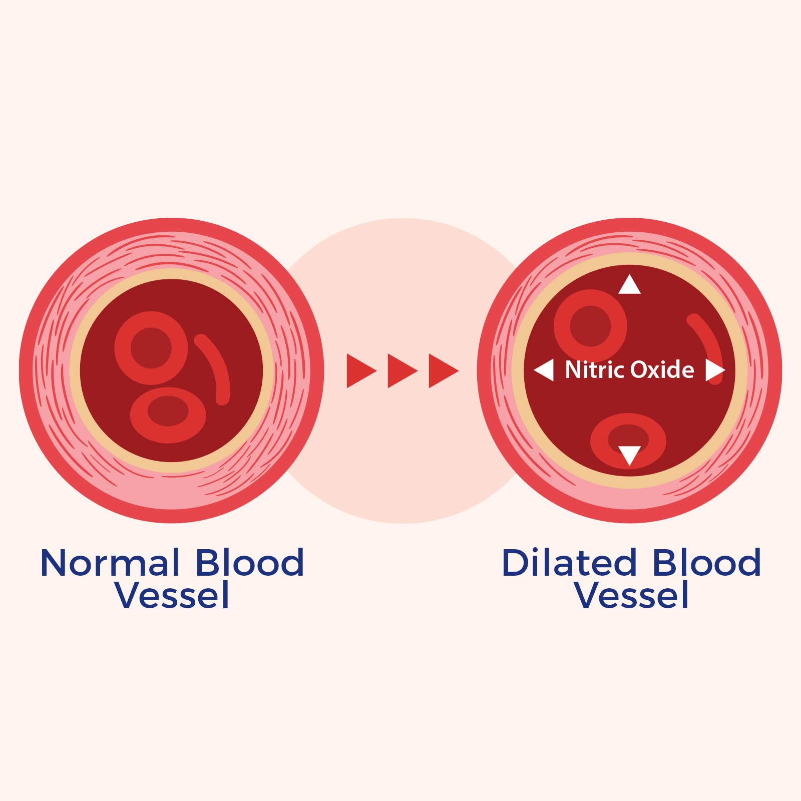 Nitric oxide for improved circulation