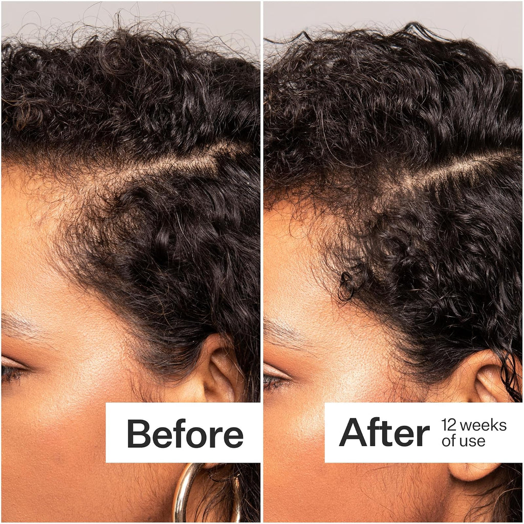 nourishing biotin for healthy hair