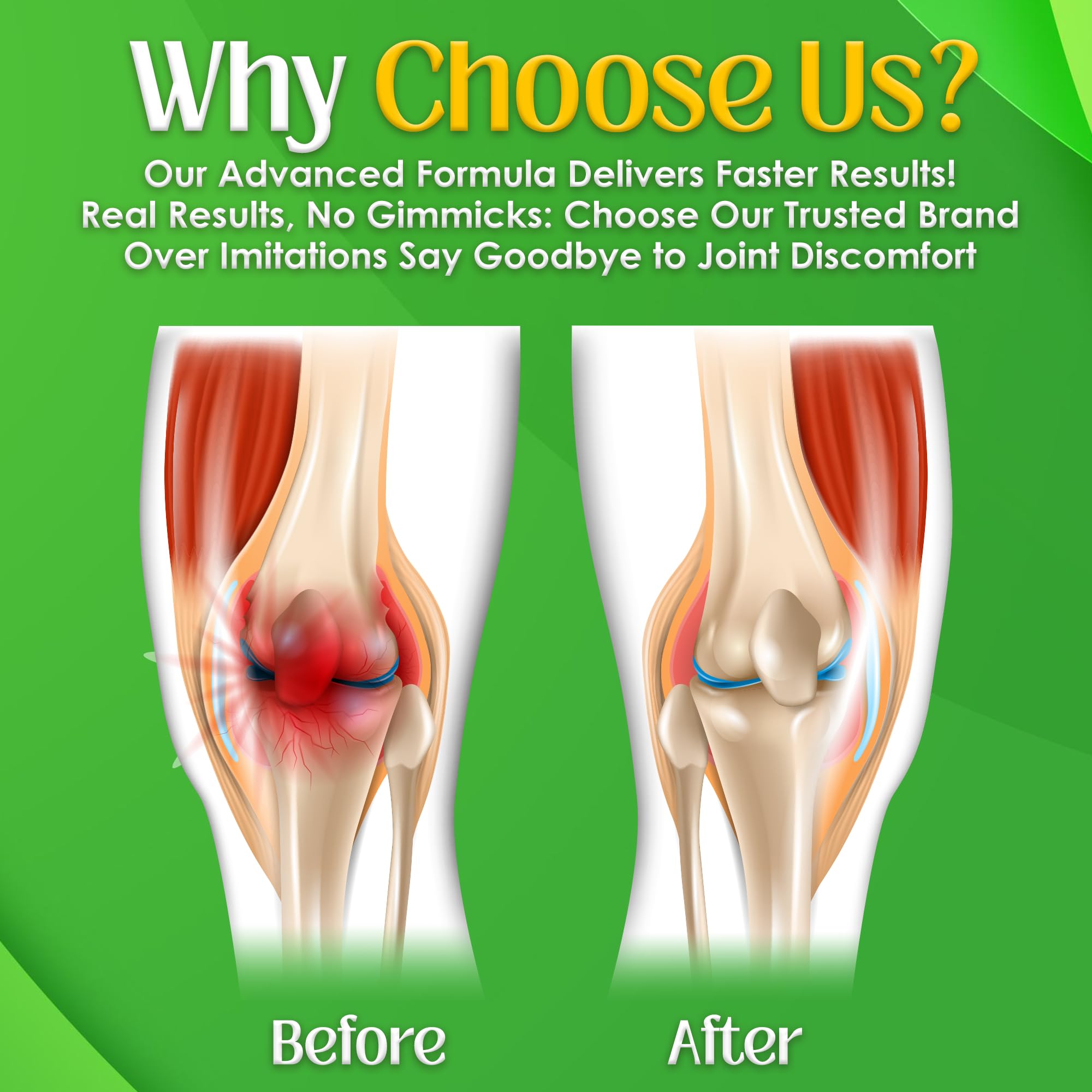 NutriGout milk thistle for detoxification