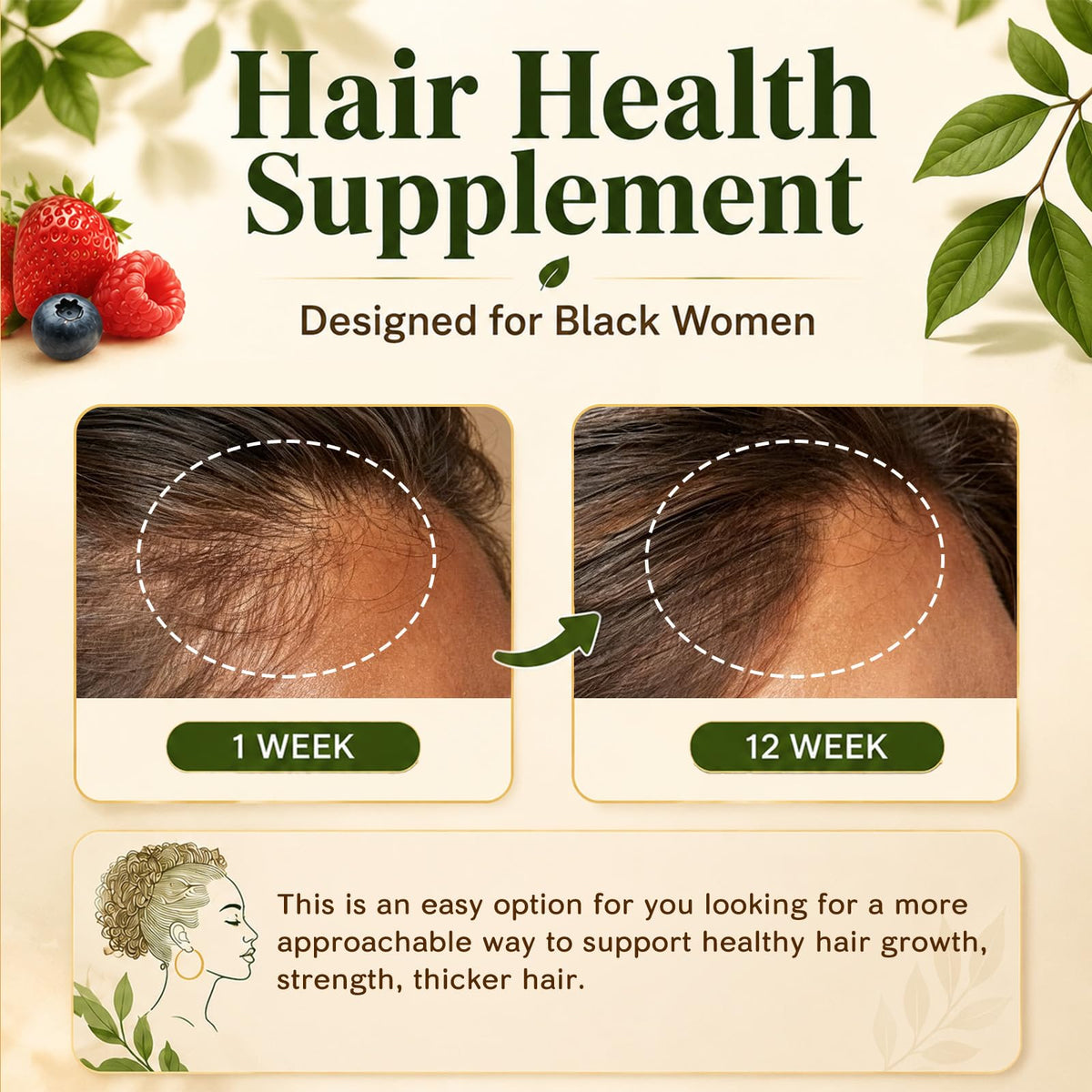 Nutritional support for hair growth