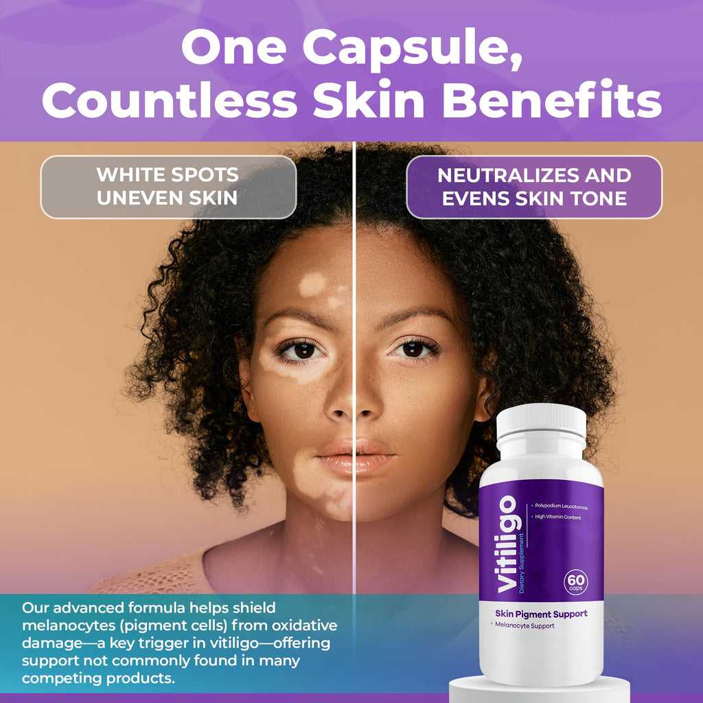 nutritional support for skin pigmentation