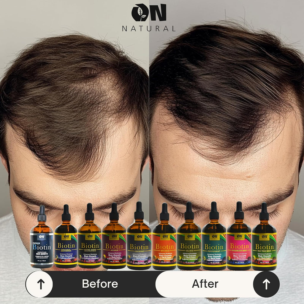 On Natural herbal black castor oil