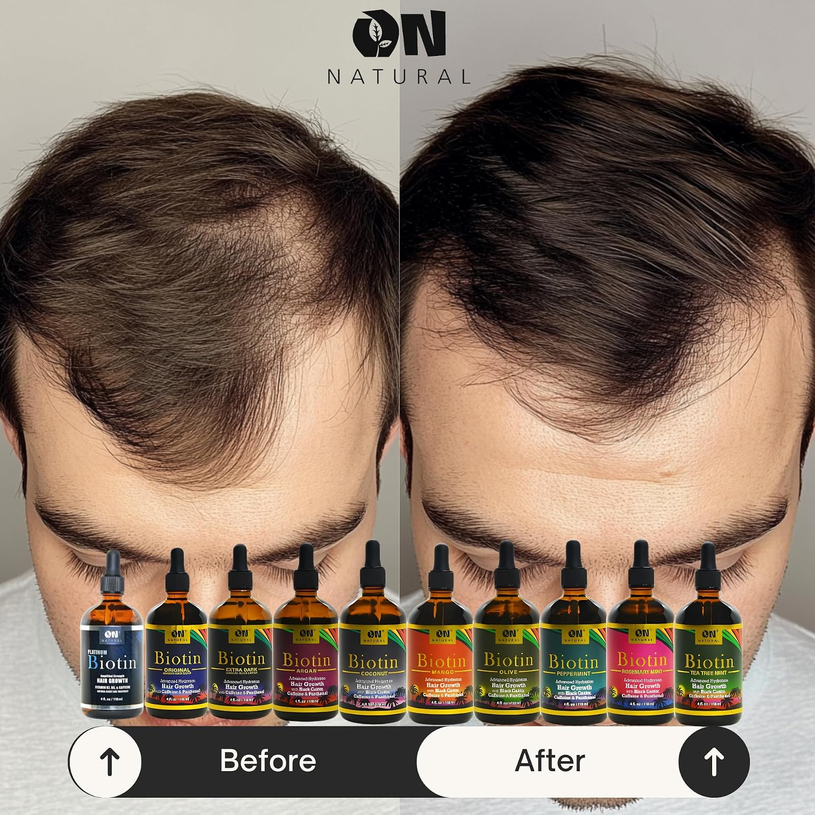 On Natural herbal black castor oil