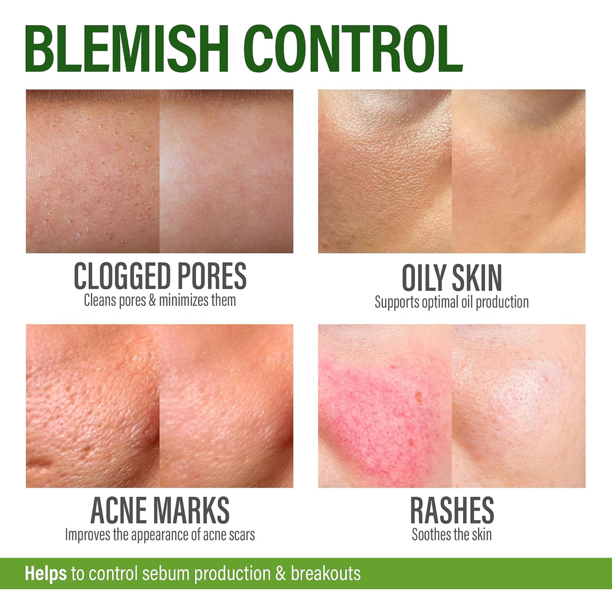 perfect skin multivitamin for men