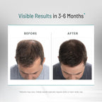 plant-based hair loss solution