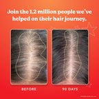 postnatal hair recovery vitamins