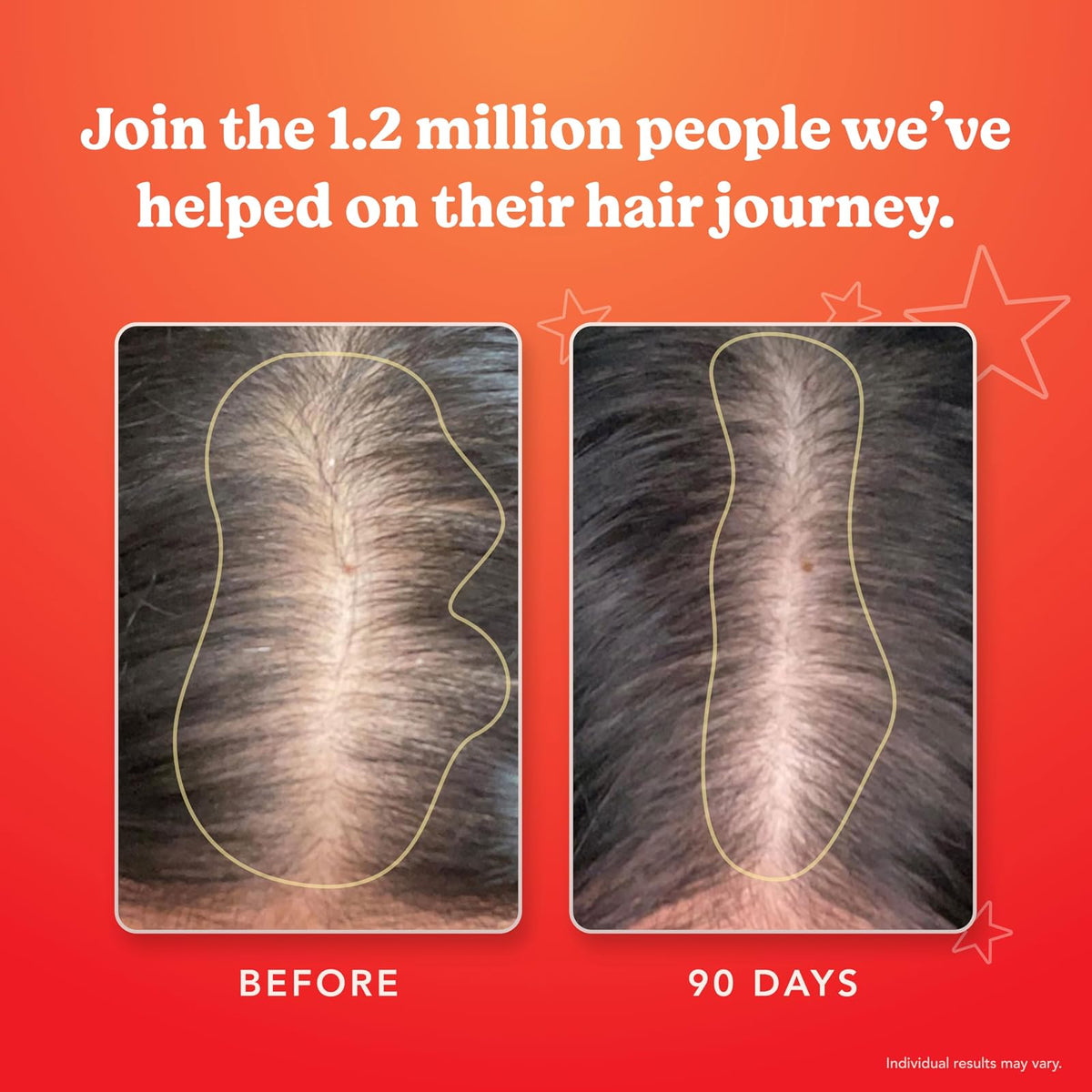 postnatal hair recovery vitamins