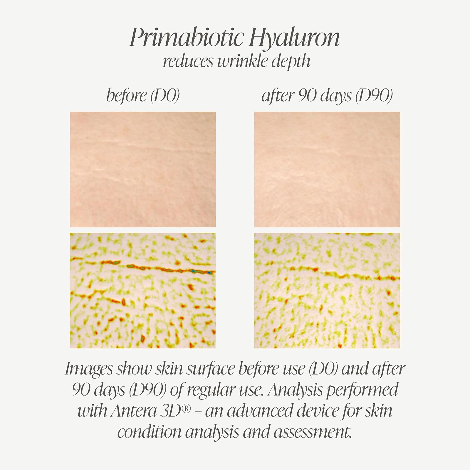 PRIMABIOTIC hyaluronic acid beauty boost