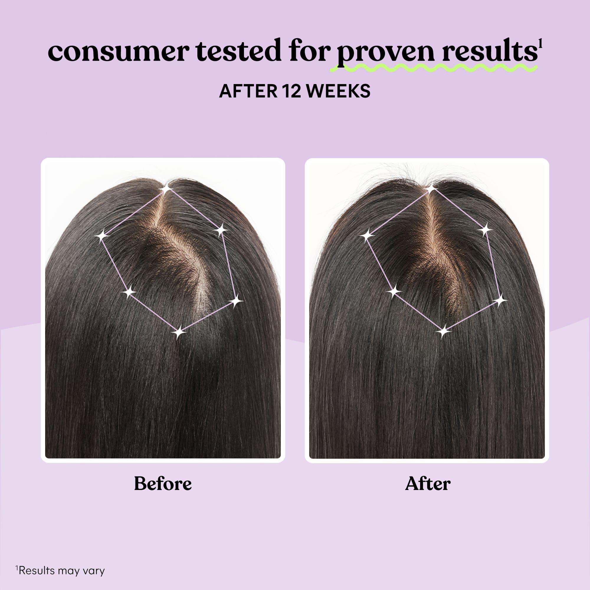 promote hair strength and volume