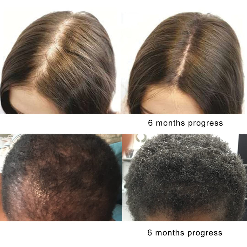 pumpkin seed oil for healthy hair growth