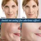 rejuvenate skin with thread lift