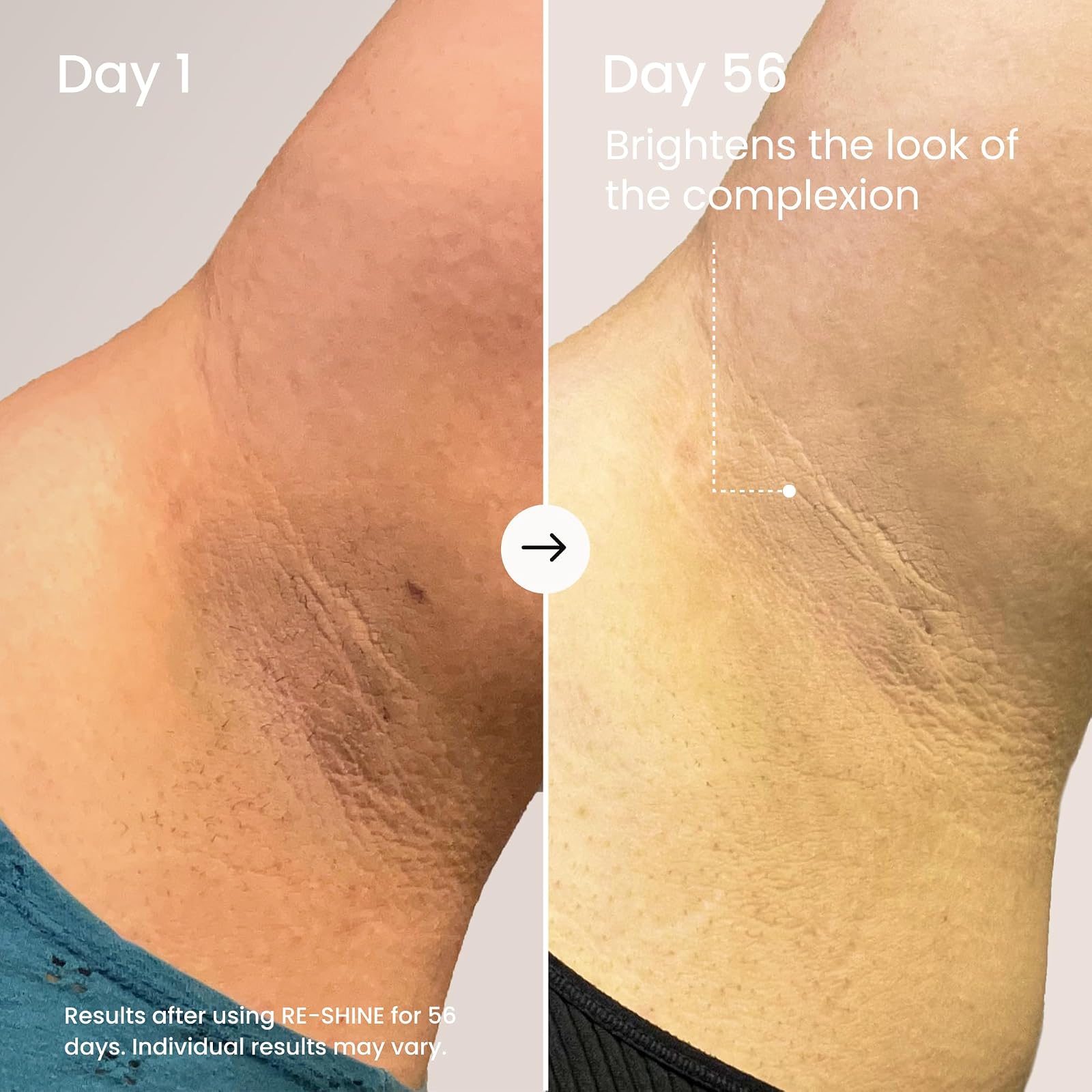 rejuvenating body serum with hyaluronic acid