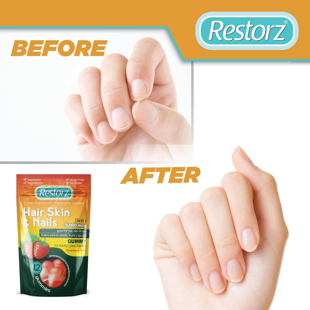 Restorz biotin gummies support skin health