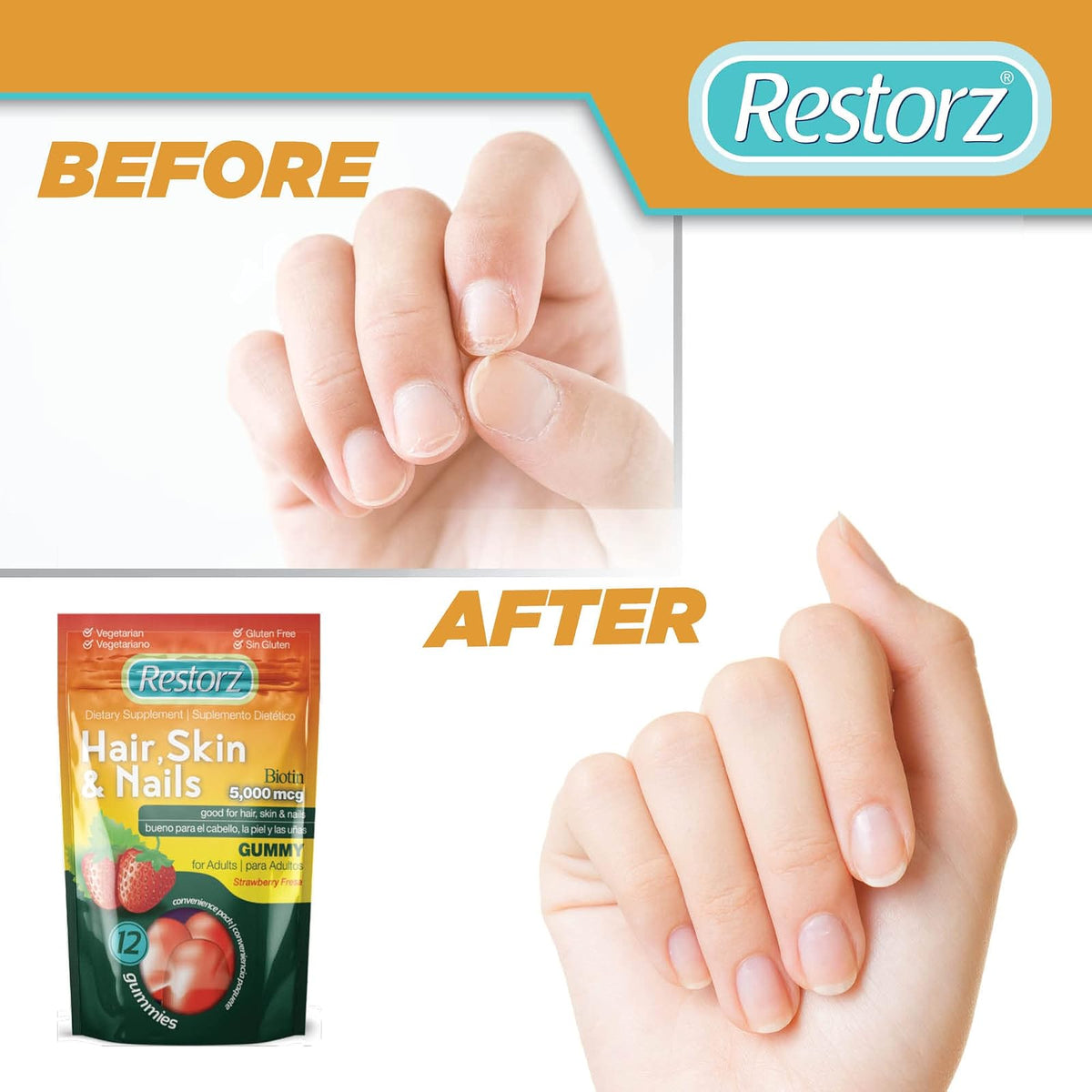 Restorz biotin gummies support skin health