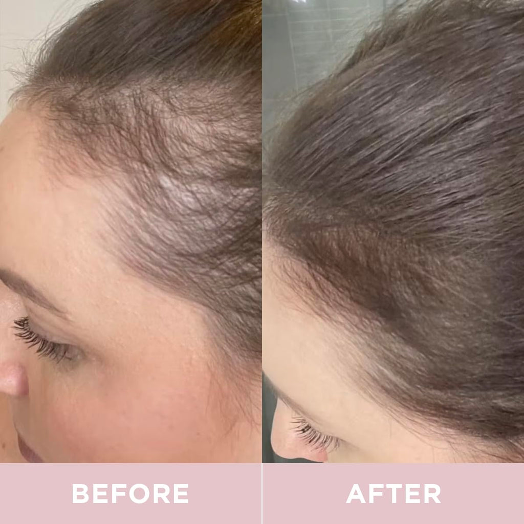 Revive collagen for joint support