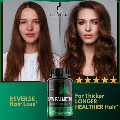 saw palmetto capsules for vitality