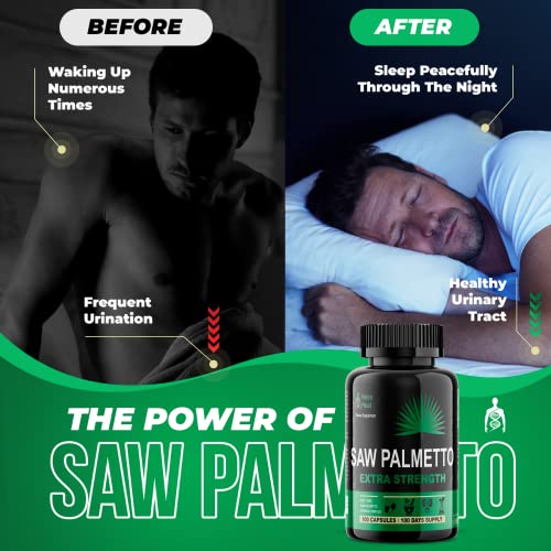saw palmetto for men's wellness