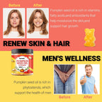 saw palmetto gummies for men