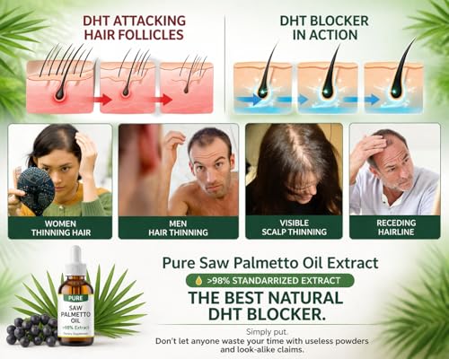 saw palmetto oil for hair vitality