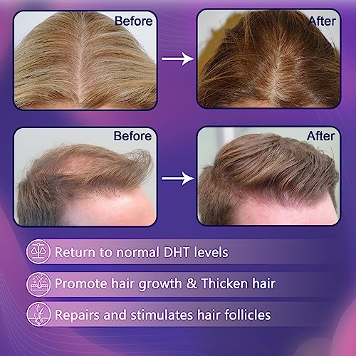 saw palmetto oil for thicker hair