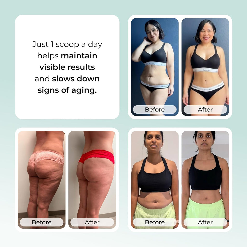 Sculpiflex collagen for radiant skin