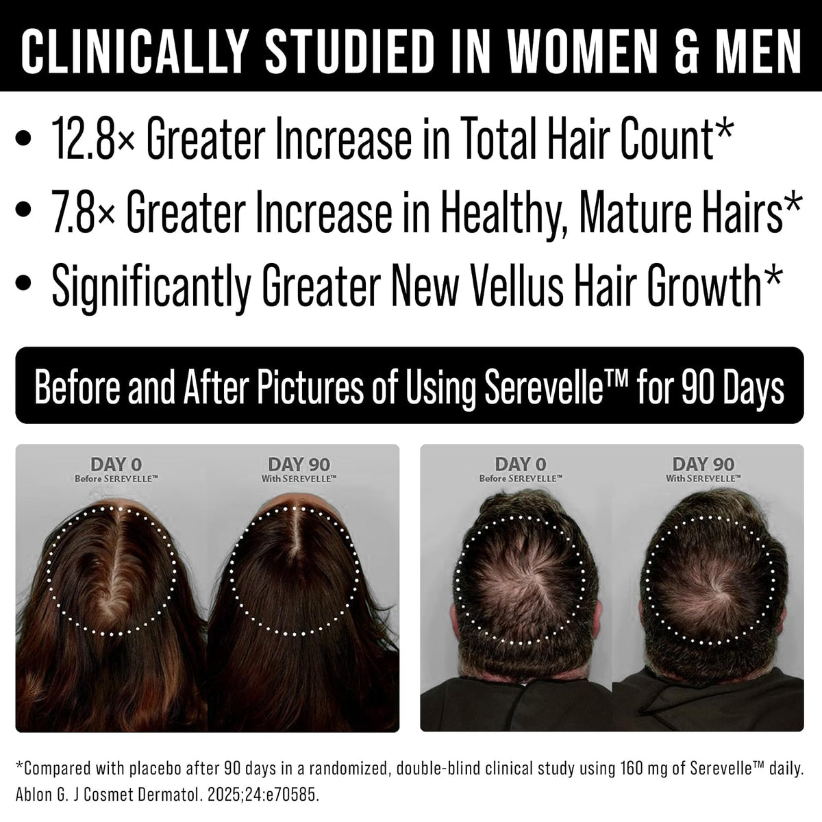 Serevelle herbal hair growth formula