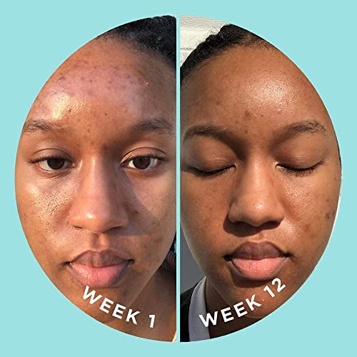 skin clarity with blended vitamins