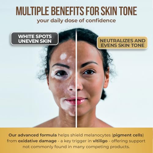 skin pigmentation enhancement formula