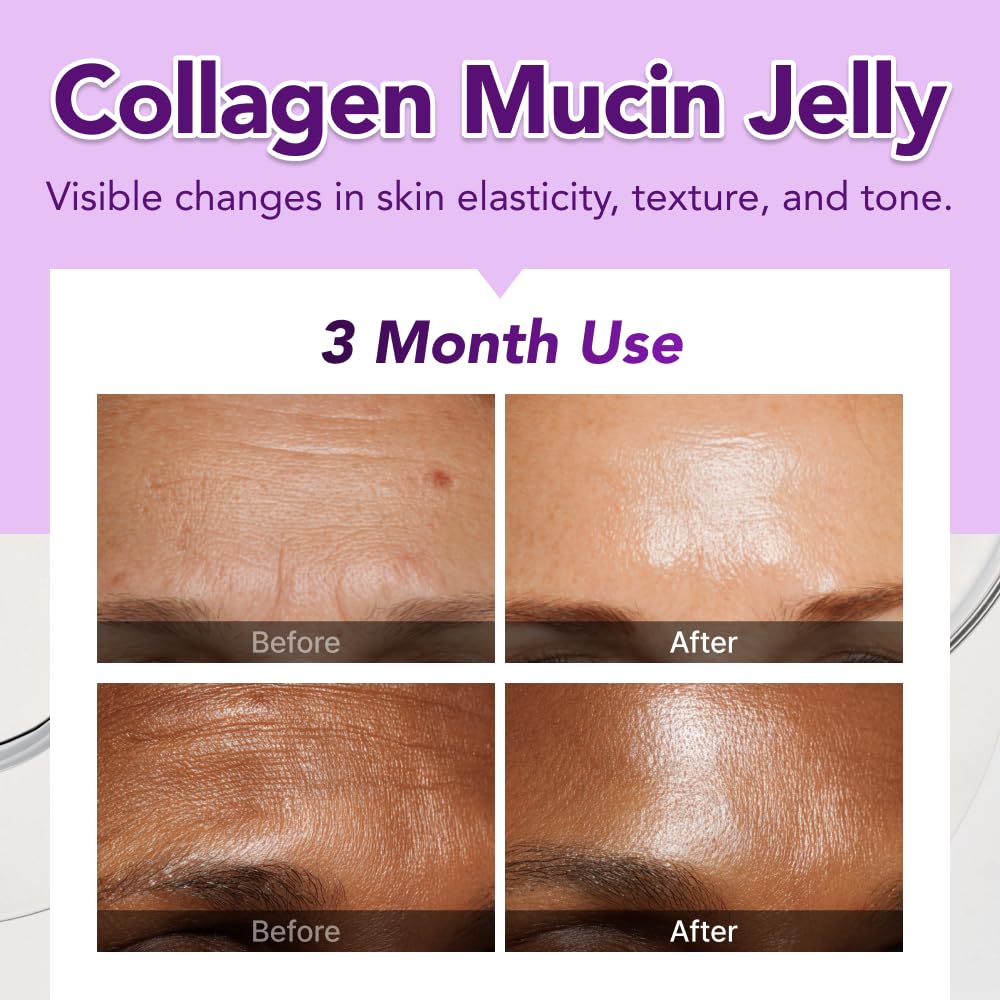 snail mucin beauty benefits for skin