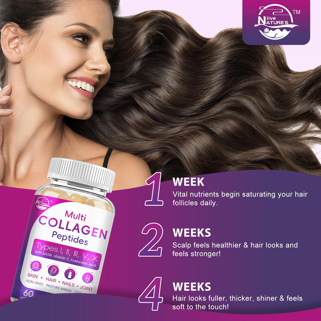 Softgels with collagen type 2