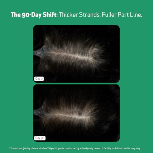 stop hair loss with natural ingredients