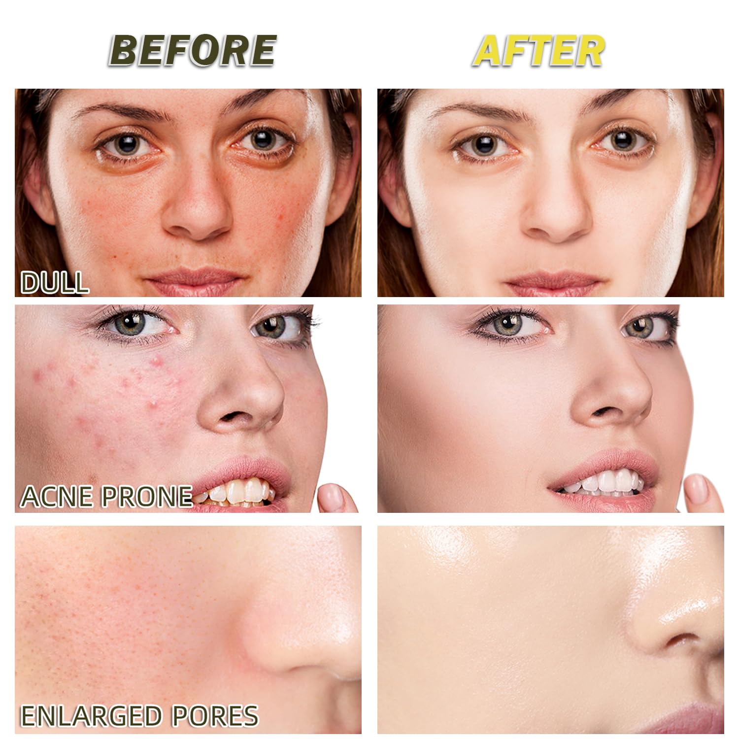 turmeric and kojic acid for dark spot reduction