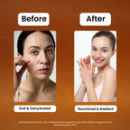 turmeric oil for dark spots