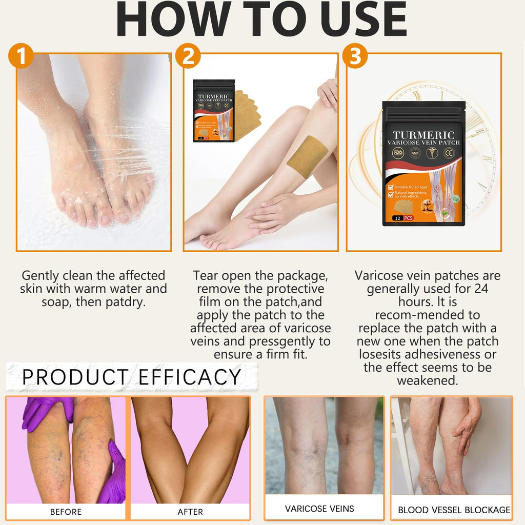 turmeric solution for varicose veins