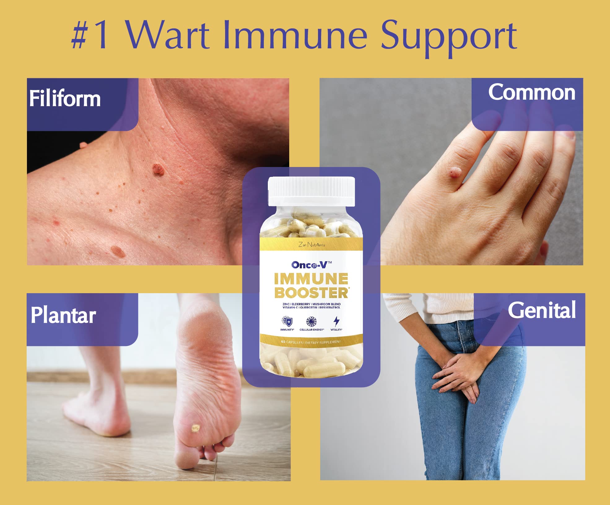 vegan curcumin supplement with zinc
