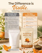Vegan softgels with saw palmetto