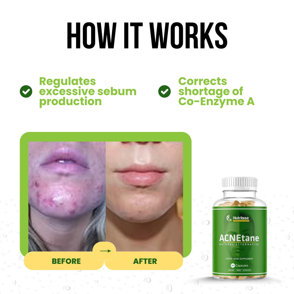 veggie softgels for clear skin