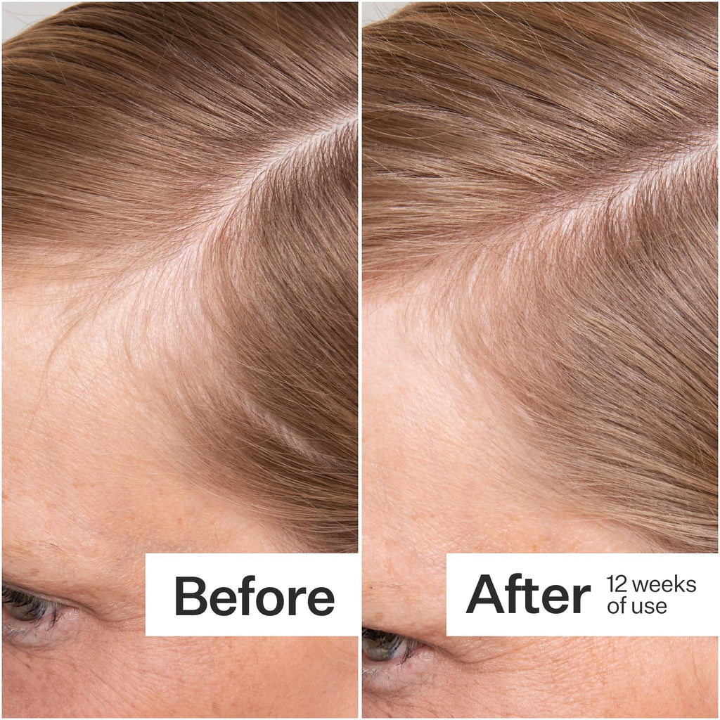 Vitamin C for healthy hair