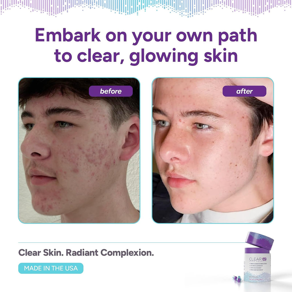 Vitamin D3 for healthy complexion