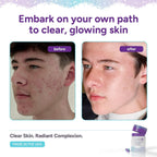 Vitamin D3 for healthy complexion